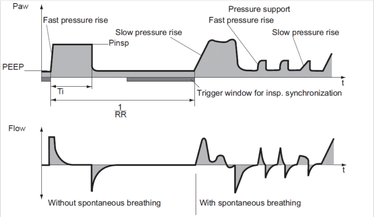 Mode dan Setting Dasar Ventilator - Keperawatan Kritis